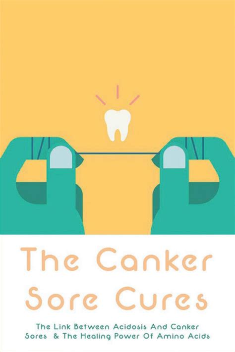 Buy The Canker Sore Cures The Link Between Osis And Canker Sores And The