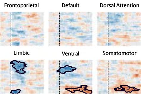 Eye Puffs Prompt Separable Sensory Affective Brain Responses In Mice People The Transmitter