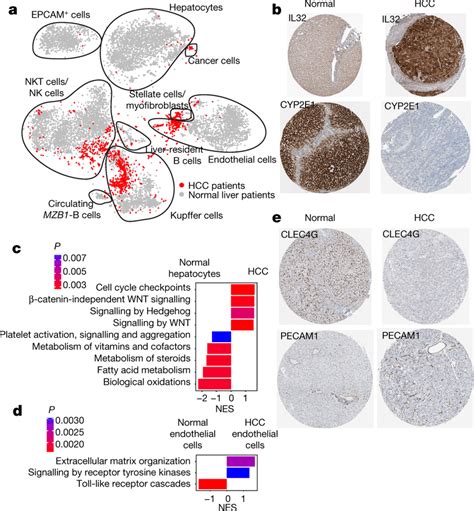 Scrna Seq Of Patient Derived Hcc Reveals Cancer Specific Gene Download Scientific Diagram