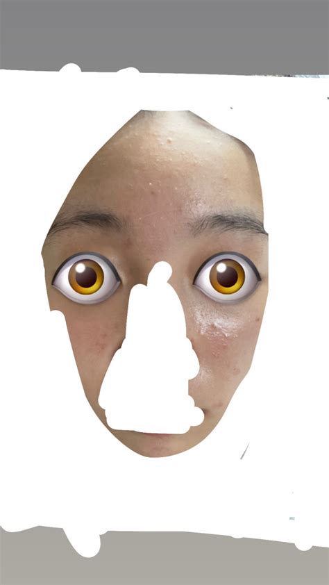 피부 안에서 나는 여드름 처치 방법 알려주세요 지식in