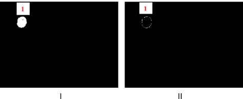 Figure 14 From Improved Image Segmentation Algorithms For Detecting Types Of Acute Lymphatic