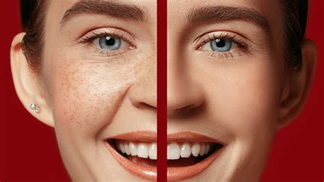 How To Remove Freckles On Face Photoshop Tutorial YouTube