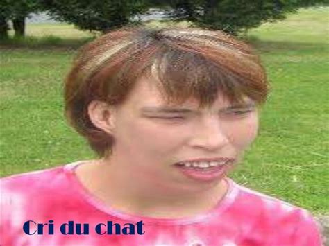 Chromosomal Aberrations Ppt