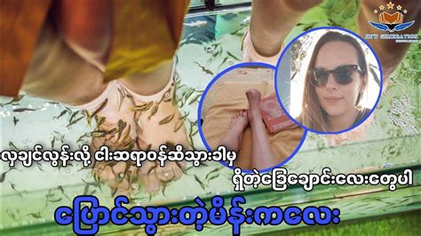 လှချင်လွန်းလို့ ငါးဆရာဝန်ဆီသွားခါမှ ရှိတဲ့ခြေချောင်းလေး‌ေတွပါ ပြောင်သ