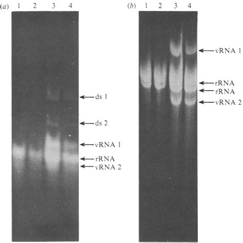 Solved Please Label On This Image Where Rrna Trna And Mrna