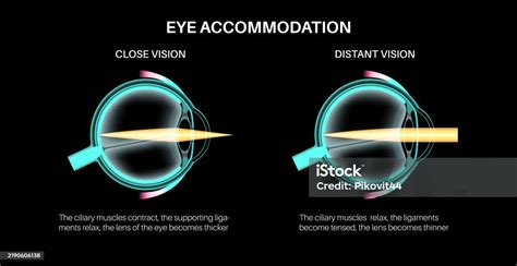 Eye Accommodation Poster Stock Illustration Download Image Now