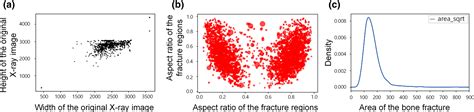 An Attention‐based Cascade R‐cnn Model For Sternum Fracture Detection