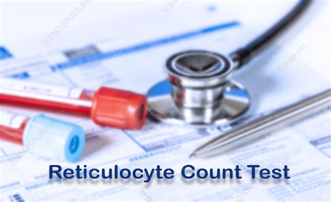 Reticulocyte Count Test Conceptual Image Stock Image F Science Photo Library