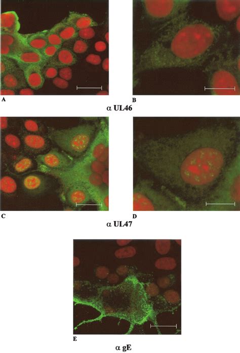 Intracellular Localization Of Prv Ul46 And Ul47 Proteins Immuno Fl Download Scientific Diagram