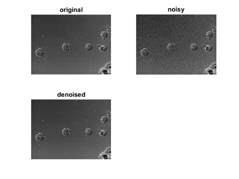 Non Local Means Image Denoising