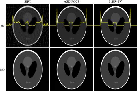 Figure 1 From Split Bregman Based Sparse View Ct Reconstruction Semantic Scholar