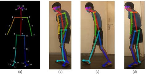 Github Himanshu Suman Spinal Deformity Dataset Constructed The