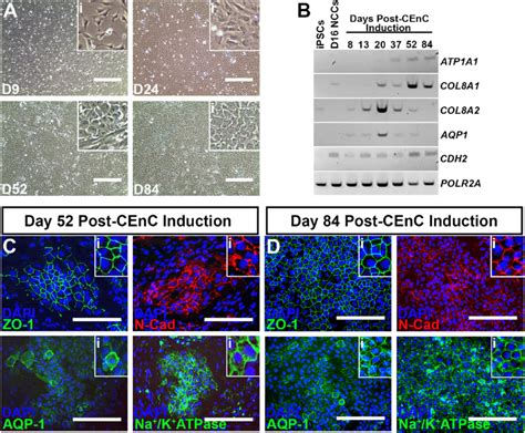 Differentiation Of Neural Crest Cells Into Corneal Endothelial Cells