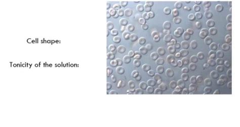 Solved Cell Shape Tonicity Of The Solution
