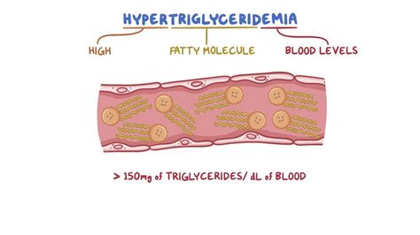 Video Hypertriglyceridemia Osmosis