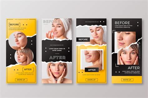 Ig 스토리 컬렉션 전후 그라데이션 무료 벡터