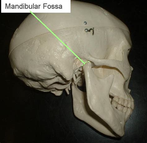 Glenoid Fossa Skull