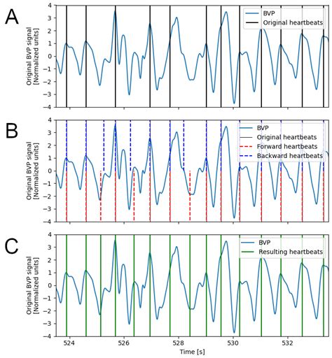 Steps Of The Rco Algorithm Portion Of Bvp Signal Affected By Motion