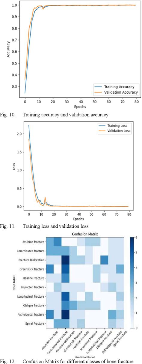 Figure 1 From Bone Fracture Detection And Classification Using Machine Learning Semantic Scholar