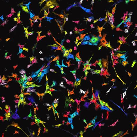 Breaking Through The Noise Of Cellular Signaling Uwmadison News