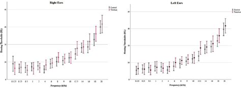 The Mean Hearing Thresholds Of The Right And Left Ears According To