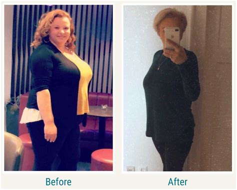 Gastric Bypass Imed Medical
