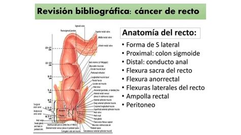 Caso Clínico. Cáncer de Recto