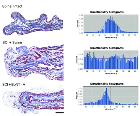 Acute Detrusor Bont A Injections After Sci Resulted In Ordered Collagen Download Scientific