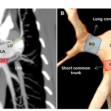 Figure Maximum Intensity Projection A And Three Dimensional Volume Download High Quality