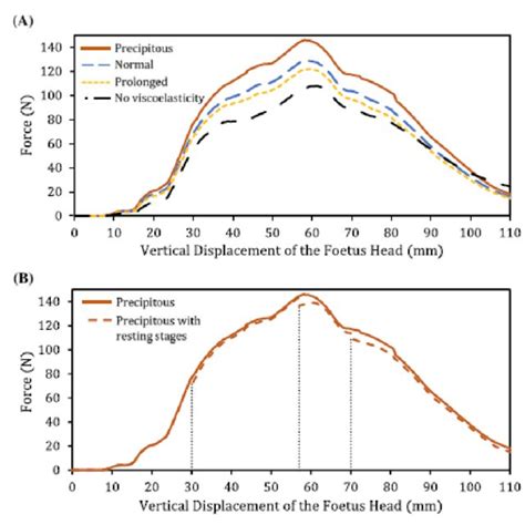 Preform Design And Strain Data Extraction Point For Dic Routine