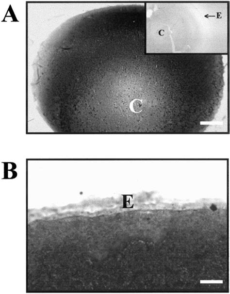 Localization Of Glut3 Transcript In The Rat Lens By In Situ Download Scientific Diagram