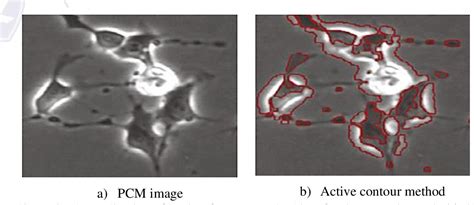 Figure 11 From Computer Aided System For Dendritic Cells Detection And