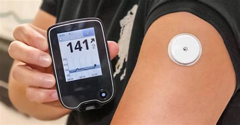 Continuous Glucose Monitoring Innovative Diabetes Care Nalam Hospital