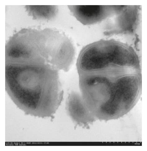 A B Transmission Electron Micrographs Of Untreated Mrsa Cells Download Scientific Diagram