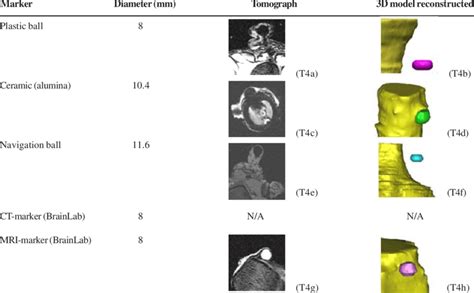 The Mri Images And Mri Derived Models Of The Fiducial Markers