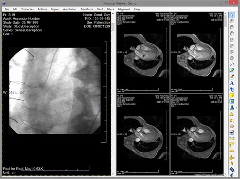dicom3dsdk之dicomobjects the crack dicomobjects crack csdn博客
