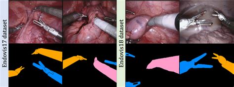 Illustration Of Endovis17 Endovis18 Datasets For Surgical Instrument Download Scientific
