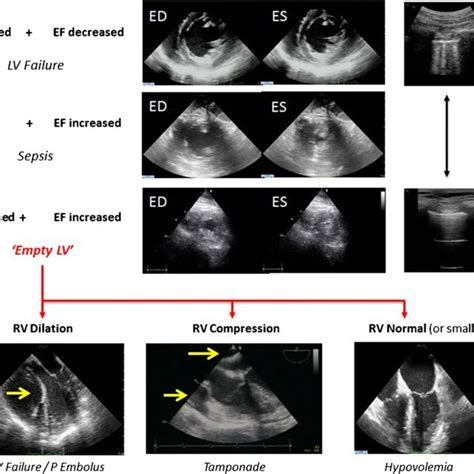 Algorithm For The Differentiation Of Hypotension Modified From Figure Download Scientific