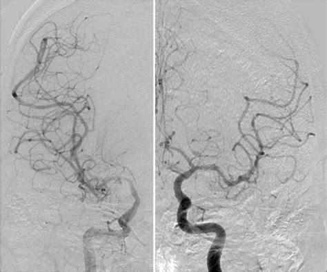 Surgical Neurology International