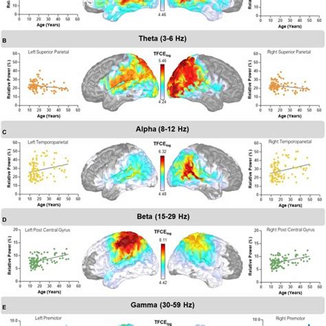 Main Effects Of Age Statistical Maps Thresholded With Threshold Free