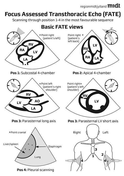 Echoshock — Pocus Uk