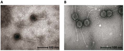 Streptococcus Pneumoniae Electron Micrograph