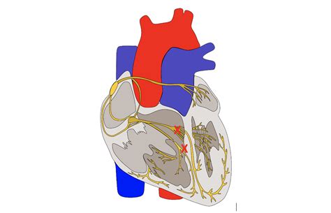 Topic Right Bundle Branch Block Left Posterior Fascicular Block 12 Lead Ecg Certification
