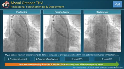 Essentials Of Lifetime Management In Patient Undergoing Tavi Using Novel Balloon Expandable