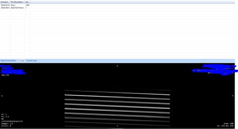 Rescale Dicom Slice Quality Or Reduce Number Of Cols And Rows · Issue