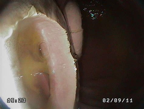 Gastroscopia En Un Perro Cuerpos ExtraÑos Gastroscopy In A Dog