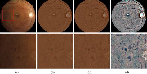 Figure 2 From Red Lesion Detection Using Dynamic Shape Features For