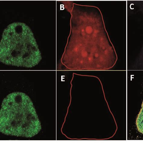 The Imaging Of Fret Efficiency Is Obtained By A Photobleaching Download Scientific Diagram