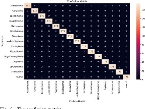 Figure 1 From Recognition Of Brain Tumors Using Deep Learning With Data Balancing Techniques And