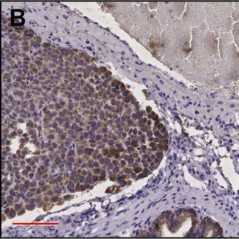 Comparing Antigen Retrieval Staining Parameters By Means Of Tissue